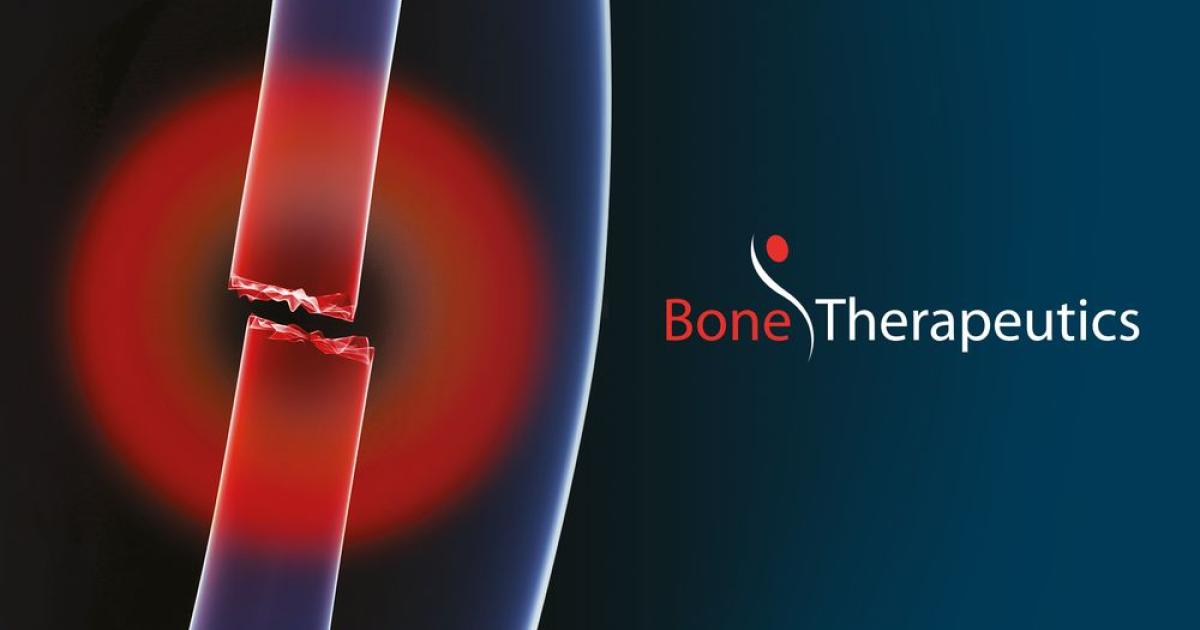 Bone Therapeutics: bonne et mauvaise nouvelle pour la biotech | Télésambre
